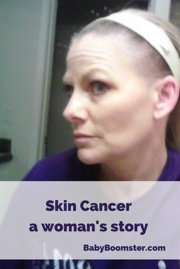 A Skin Cancer Survivor’s Story and Warning for You